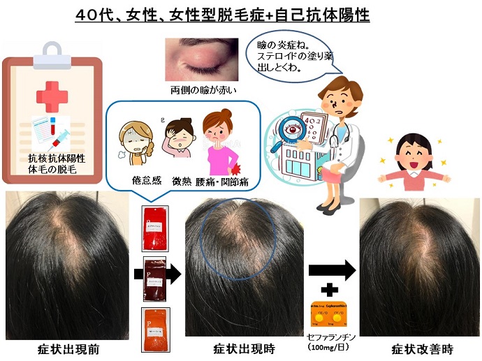 患者様の声：”眼科に行ったら瞼の炎症と言われ塗り薬を出されました！” 患者様からの声・メディア掲載・クリニックからのお知らせ 名古屋kクリニック